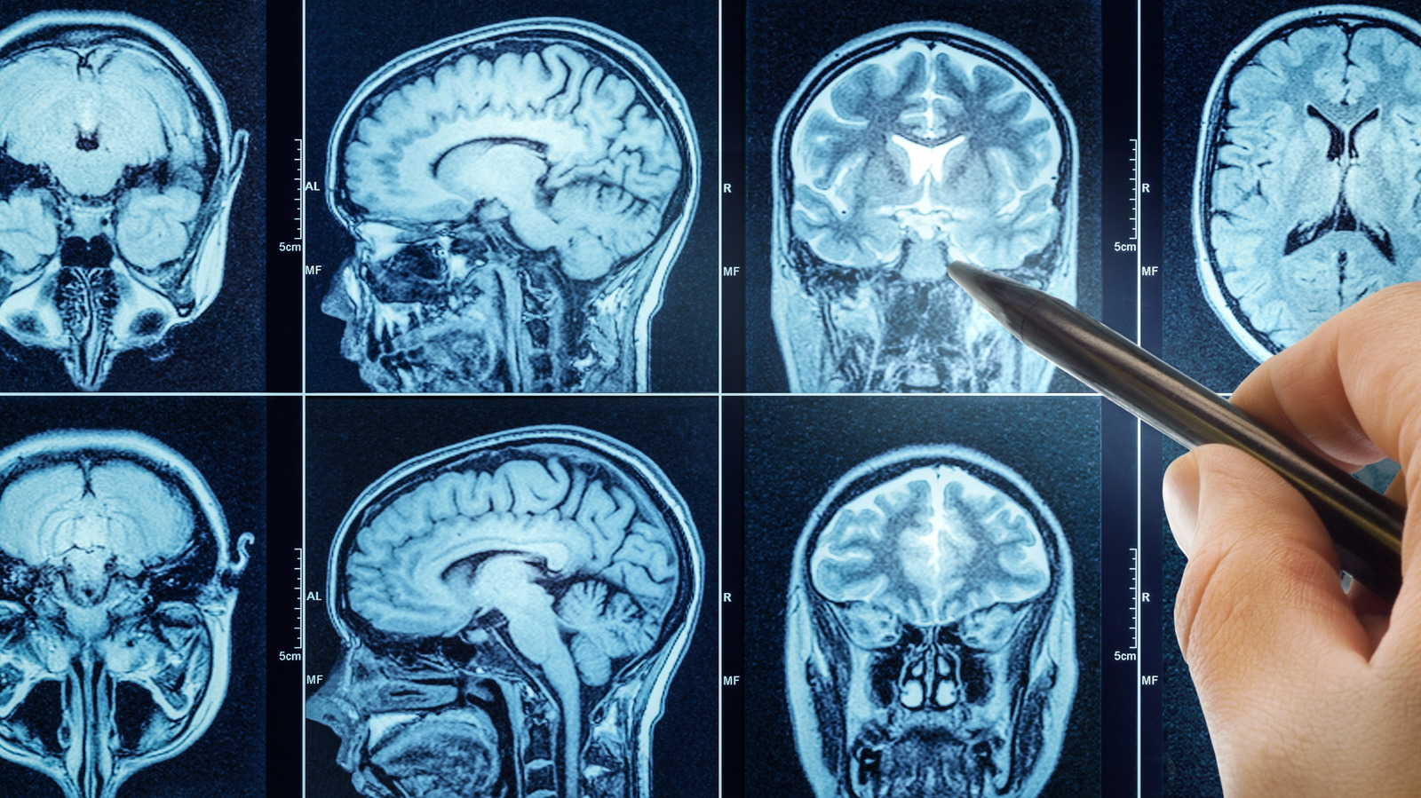 The Final Reflex Doctors Check Before Declaring Brain Death